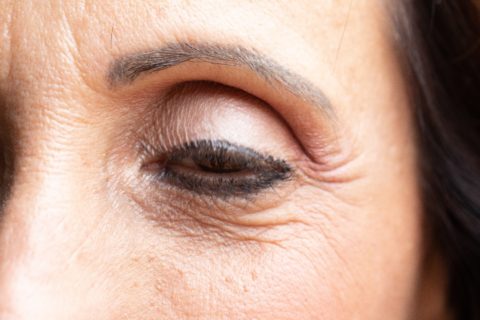 Drooping Eyelids Can Affect Your Vision | Sight Eye Clinic Explains
